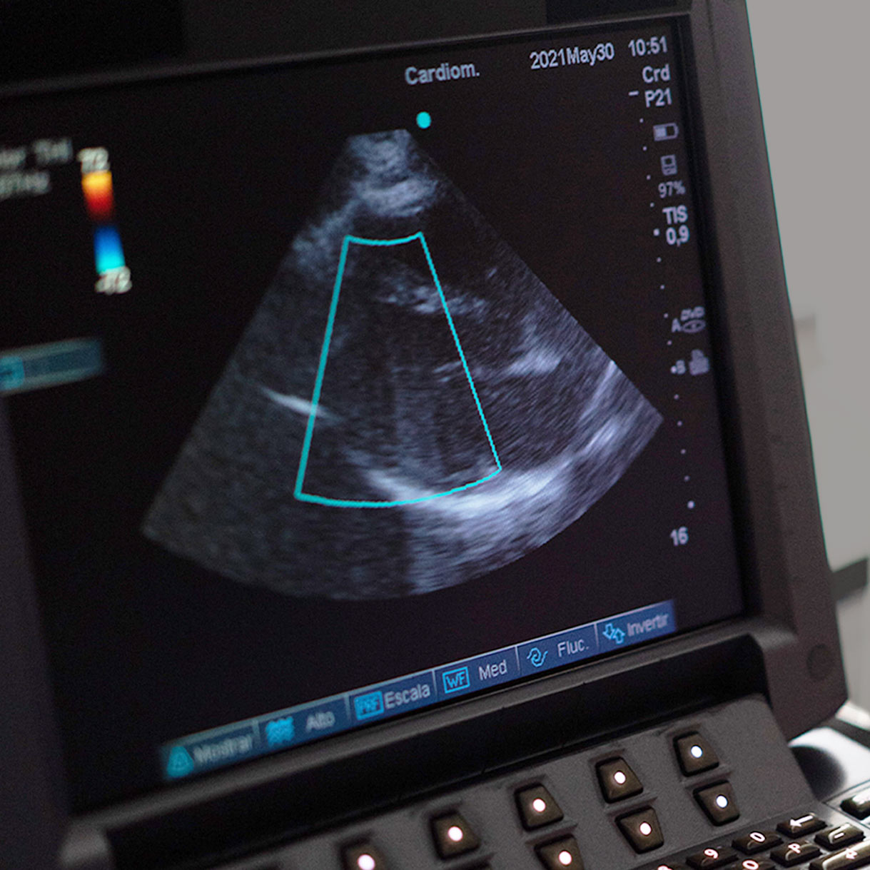 Comparison of Radiation Exposure Among Interventional ...
